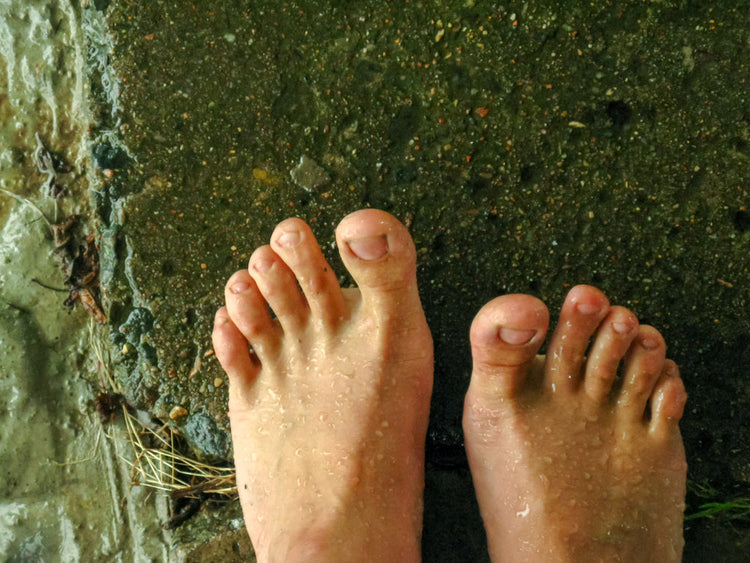 Watch Rashes: How to Prevent Irritation from the Watch Strap | SkinEasi ...