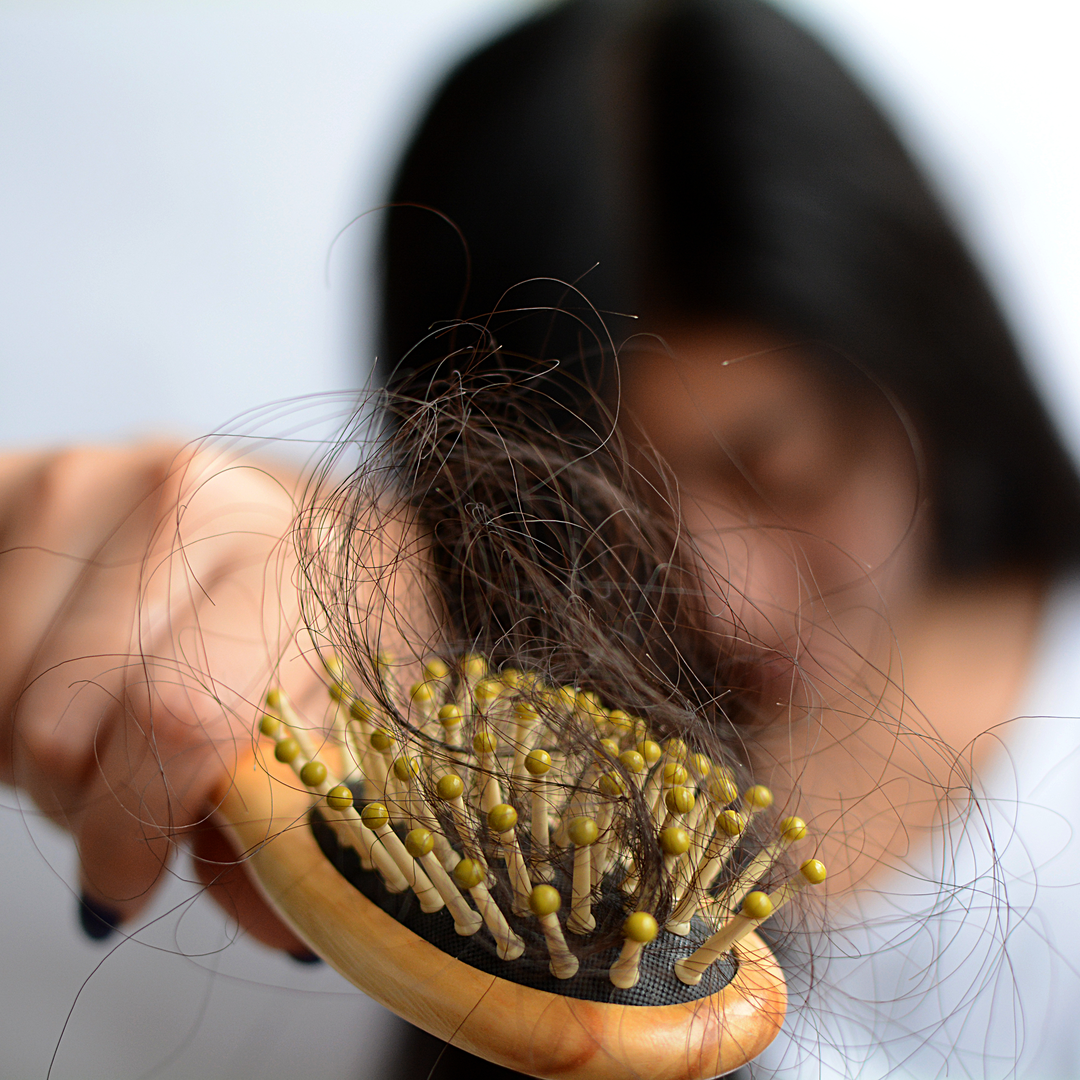 How to Deal with Post-Covid Hair Loss | SkinEasi – Skineasi